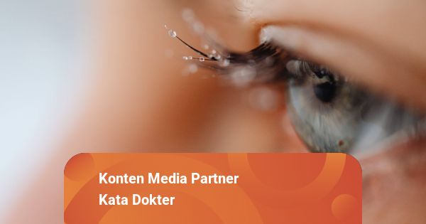 7 Penyebab Mata Belekan dan Tanda-tandanya yang Perlu Diwaspadai | kumparan.com